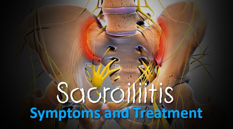 Sacroiliitis Treatments - What is Sacroiliitis and Symptoms